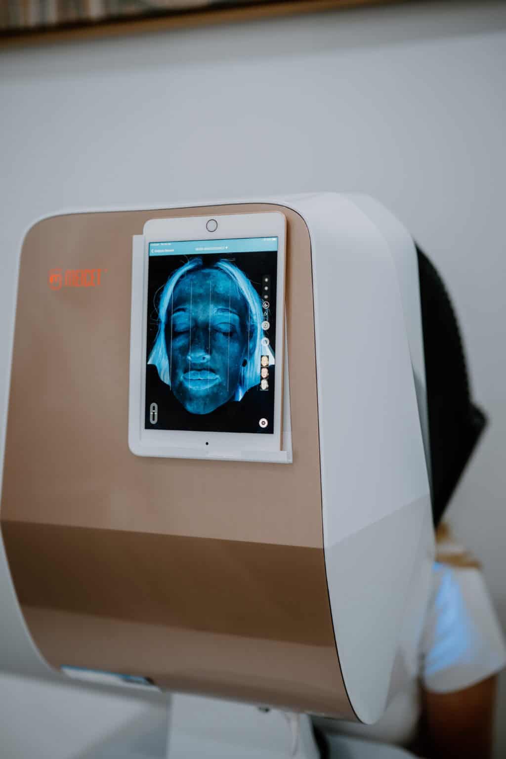 Scan x skin analysis - Dermaluxe Beauty